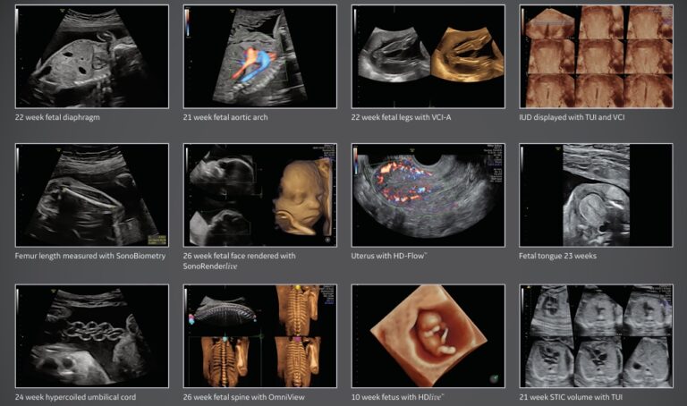 Pregnancy scan in Dubai | Pregnancy ultrasound scan cost in Dubai